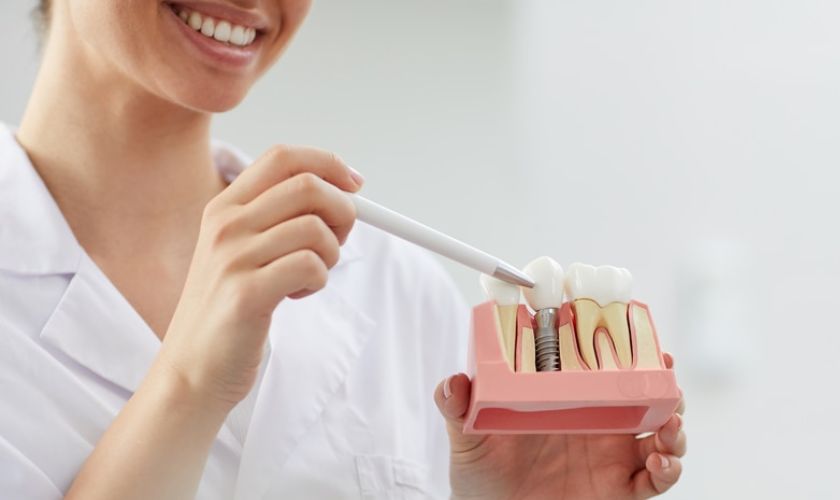 Dental implants as a solution to replace lost teeth